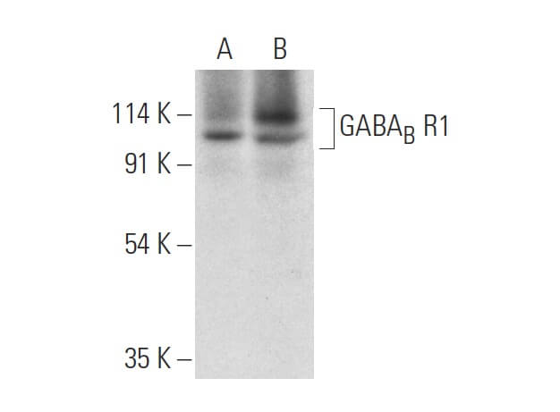 Anti-GABAB R1 Antibody (C-11) | SCBT - Santa Cruz Biotechnology