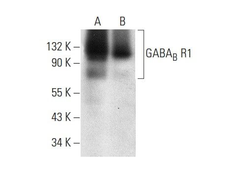 GABAB R1抗体 (D-2) | SCBT - Santa Cruz Biotechnology