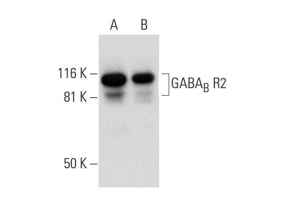 GABAB R2 Antibody (H-300) | SCBT - Santa Cruz Biotechnology