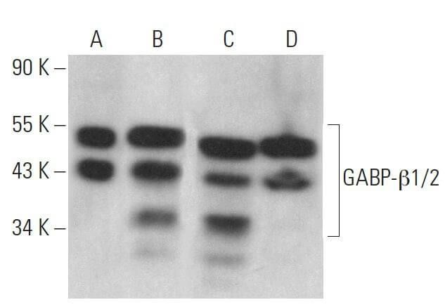 GABP-β1/2 Antibody (E-1) | SCBT - Santa Cruz Biotechnology