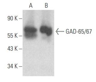 GAD-65/67 Antibody (C-9) - Western Blotting - Image 354445