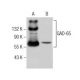 Anti-GAD-65 Antibody (A-3) | SCBT - Santa Cruz Biotechnology