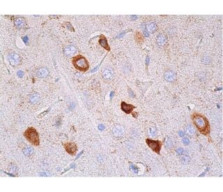 GAD-67 Antibody (F-6) | SCBT - Santa Cruz Biotechnology