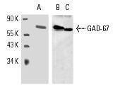 GAD-67 Antibody (H-101) | SCBT - Santa Cruz Biotechnology