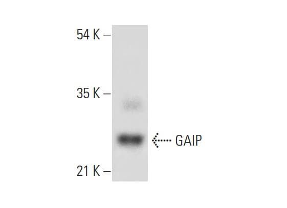 GAIP Antibody (B-6) | SCBT - Santa Cruz Biotechnology