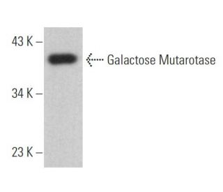 Galactose Mutarotase Antibody (E-4) | SCBT - Santa Cruz Biotechnology