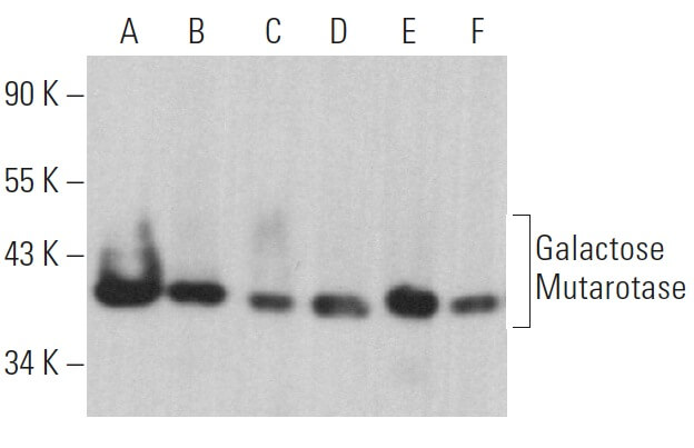 Galactose Mutarotase Antibody (E-4) | SCBT - Santa Cruz Biotechnology