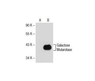 Galactose Mutarotase Antibody (G-7) | SCBT - Santa Cruz Biotechnology