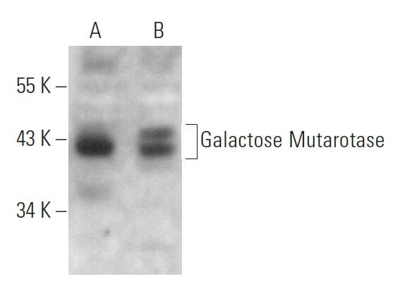 Galactose Mutarotase Antibody (G-7) | SCBT - Santa Cruz Biotechnology