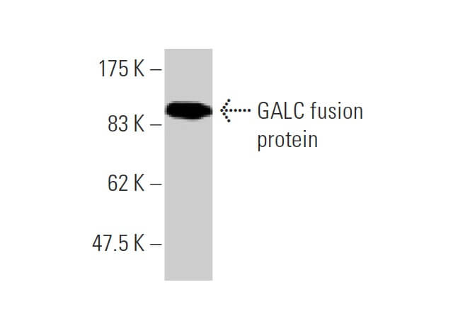 Anti-GALC Antibody (2D1) | SCBT - Santa Cruz Biotechnology