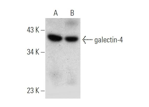 galectin-4 Antibody (B-9) | SCBT - Santa Cruz Biotechnology