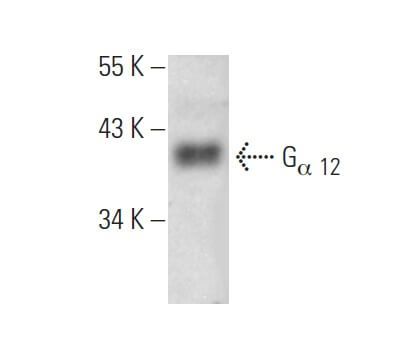 Gα 12 Antibody (B-5) | SCBT - Santa Cruz Biotechnology