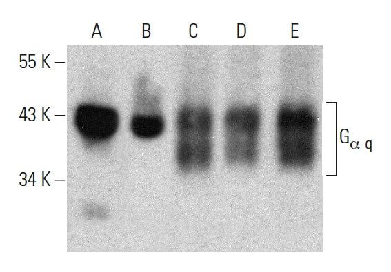 Gα q抗体 (10) | SCBT - Santa Cruz Biotechnology