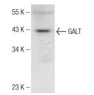 GALT Antibody (G-1) | SCBT - Santa Cruz Biotechnology