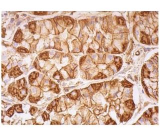 γ-Actin Antibody (1-17) | SCBT - Santa Cruz Biotechnology