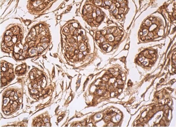 γ-Actin Antibody (1-17) | SCBT - Santa Cruz Biotechnology