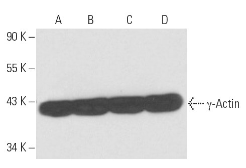 γ-Actin Antibody (1-17) | SCBT - Santa Cruz Biotechnology
