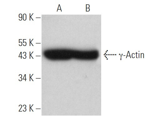 γ-Actin Antibody (1-17) | SCBT - Santa Cruz Biotechnology