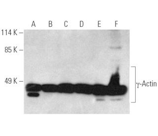 Anti-γ-Actin Antibody (1-17) | SCBT - Santa Cruz Biotechnology