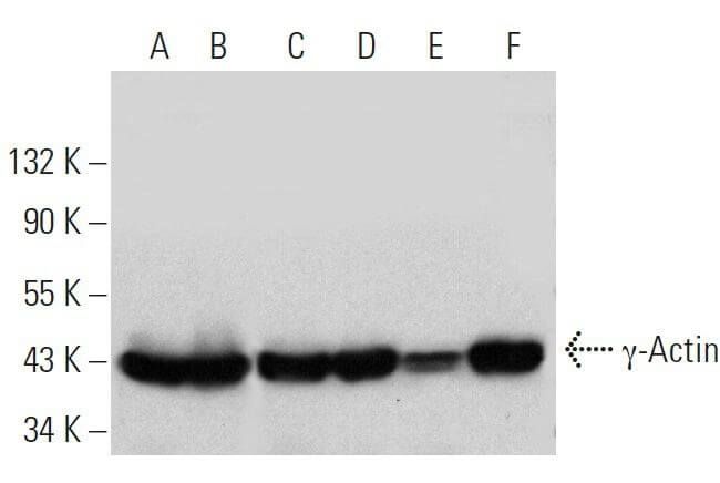 γ-Actin Antibody (1-24) | SCBT - Santa Cruz Biotechnology