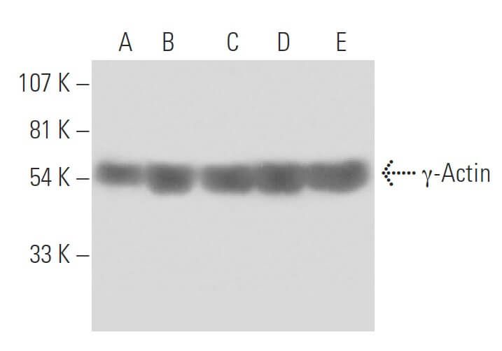 γ-Actin抗体 (2-4) | SCBT - Santa Cruz Biotechnology