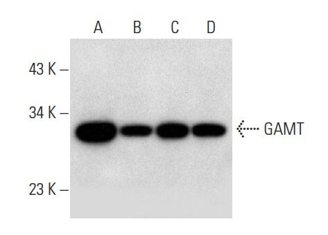 GAMT Antibody (A-11) | SCBT - Santa Cruz Biotechnology