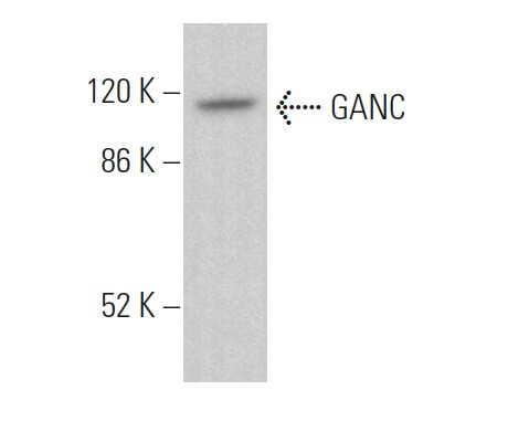 GANC Antibody (D-1) | SCBT - Santa Cruz Biotechnology