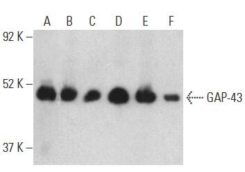 GAP-43 Antibody (7B10) | SCBT - Santa Cruz Biotechnology