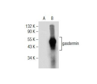 Anti-gasdermin Antibody (H-6) | SCBT - Santa Cruz Biotechnology