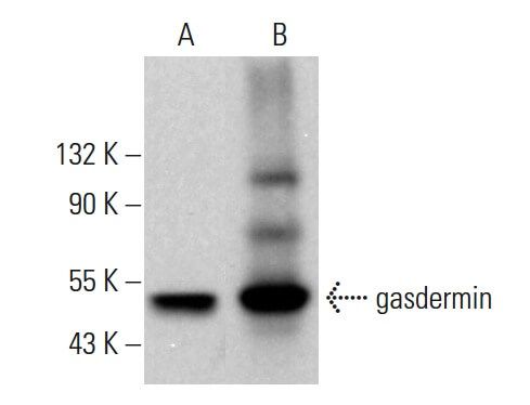 gasdermin Antibody (H-6) | SCBT - Santa Cruz Biotechnology