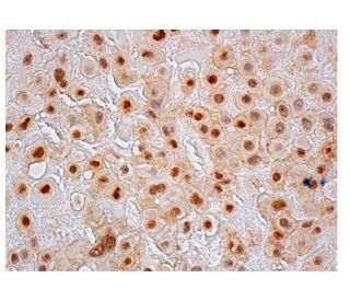GATA-3 Antibody (HG3-31) - Immunohistochemistry - Image 352892