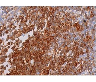 GBP1 Antibody (1B1) - Immunohistochemistry - Image 383629