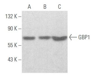 GBP1 Antibody (1B1) - Western Blotting - Image 355686