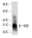 GCK Antibody (G-5) | SCBT - Santa Cruz Biotechnology