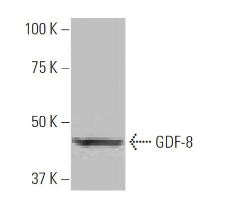 GDF-8 Antibody (1L4) | SCBT - Santa Cruz Biotechnology