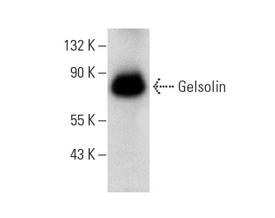 Gelsolin Antibody (F-3) | SCBT - Santa Cruz Biotechnology