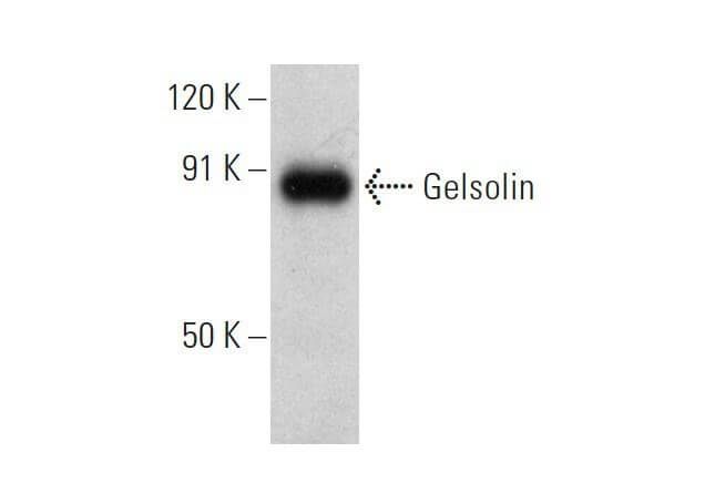 Gelsolin抗体 (F-3) | SCBT - Santa Cruz Biotechnology