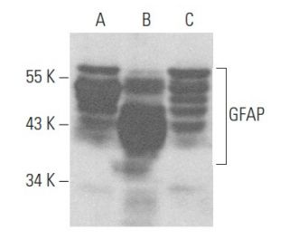 GFAP Antibody (2E1) - Western Blotting - Image 353941