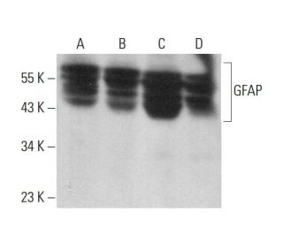 GFAP Antibody (2E1) - Western Blotting - Image 376370