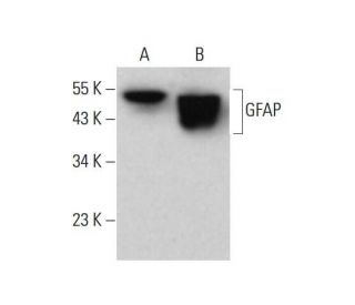GFAP Antibody (2E1) - Western Blotting - Image 376636