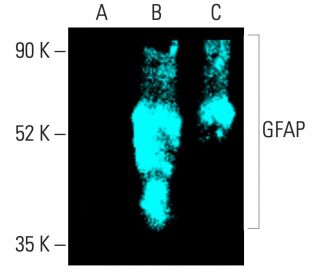 GFAP Antibody (2E1) - Western Blotting - Image 401517