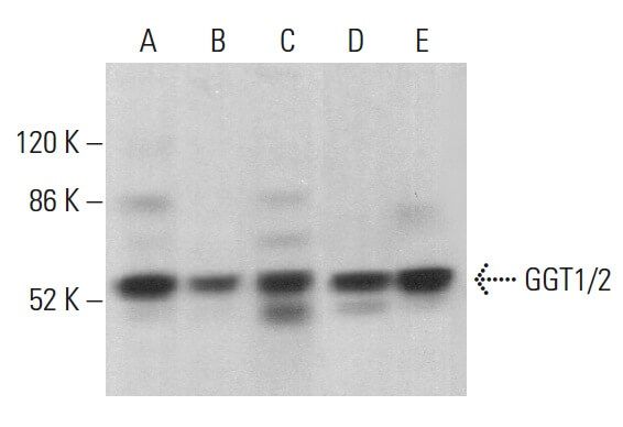 GGT1/2抗体 (A-4) | SCBT - Santa Cruz Biotechnology