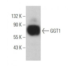 Anti-GGT1 Antibody (E-5) | SCBT - Santa Cruz Biotechnology