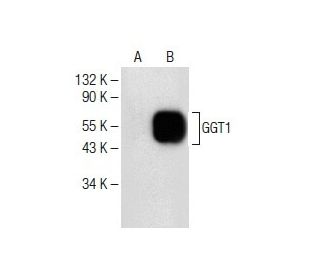Anti-GGT1 Antibody (F-7) | SCBT - Santa Cruz Biotechnology