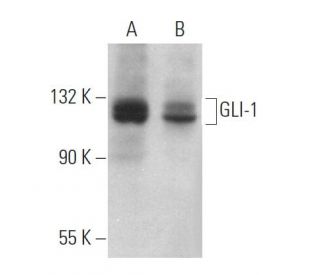 Anti-GLI-1/GLI1 Antibody (A-7) | SCBT - Santa Cruz Biotechnology