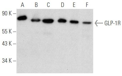 GLP-1R Antibody (D-6) | SCBT - Santa Cruz Biotechnology