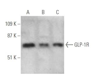 GLP-1R Antibody (D-6) - Western Blotting - Image 394984