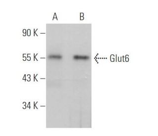 Anti-Glucose Transporter Glut6 Antibody (B-3) | SCBT - Santa Cruz ...