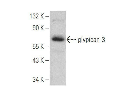 Anti-glypican-3 Antibody (H-10) | SCBT - Santa Cruz Biotechnology