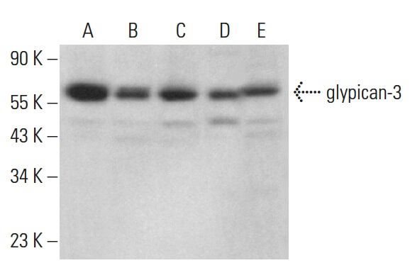glypican-3抗体 (H-10) | SCBT - Santa Cruz Biotechnology